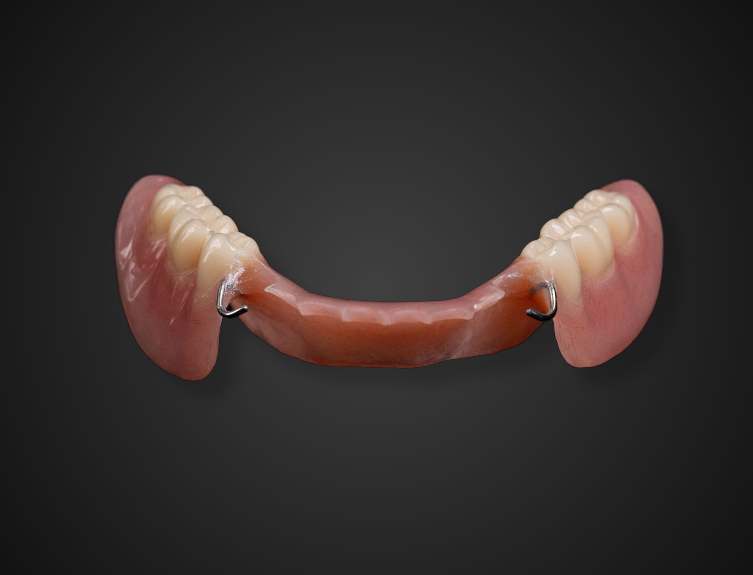 Removable Dentures & Partials | NuArt Dental Lab